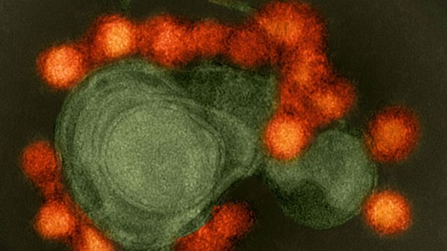 Zika Virus Vaccine Approach Shows Promise for Brain Cancer Cells ...