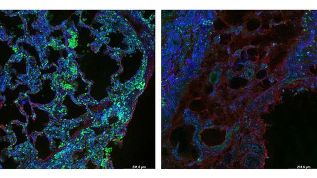 Protein Sensor Plays a Key Role in Lung Fibrosis | Technology Networks