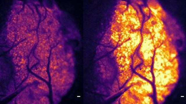 New Bioluminescence Imaging Technique Illuminates Oxygen’s Journey in ...