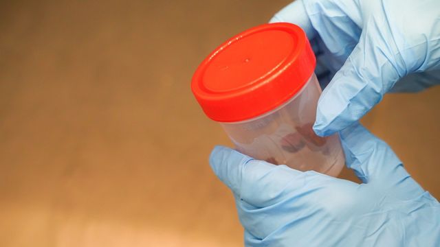 Stool Transplant Improves Motor Function in Parkinson's Disease ...