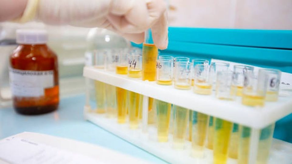 Discover Fast And Reproducible Cytokine Quantitation Technology Networks