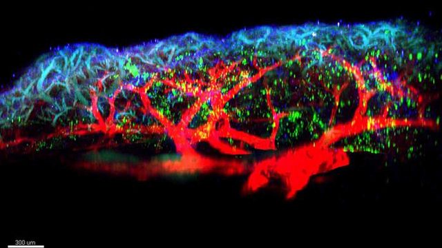 New Study Identifies Molecule Triggering Allergic Reactions ... New Study Identifies Molecule Triggering Allergic Reactions ...