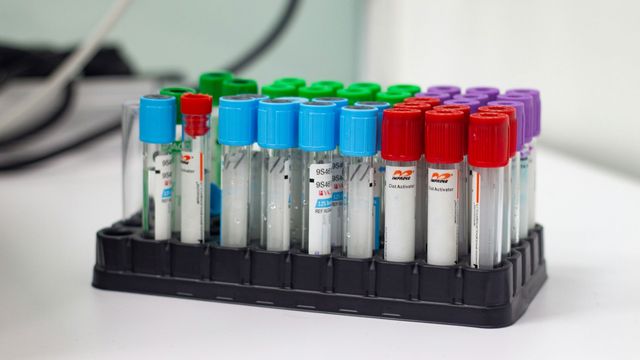 Urine Test Detects DNA Released by Head and Neck Tumors | Technology ...