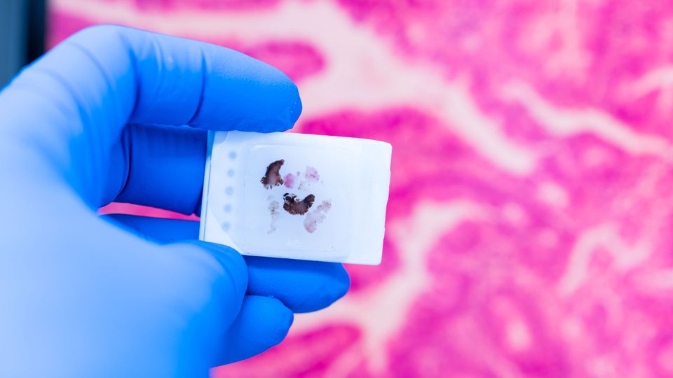 Ensure High-Quality Nucleic Acids Analysis from FFPE Samples ...