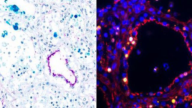 Cell Receptors in Dairy Cows a Prime Target for Influenza Infection ...