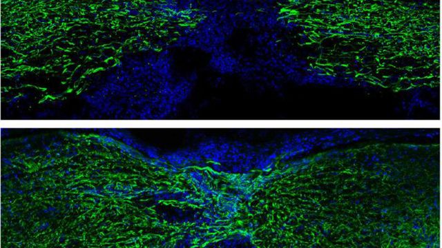 Zebrafish Reveal Neuron Protection as Critical Step in Spinal Cord ...
