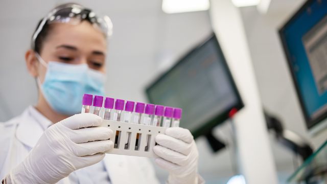 Overcoming Bioanalysis Challenges With AI | Technology Networks