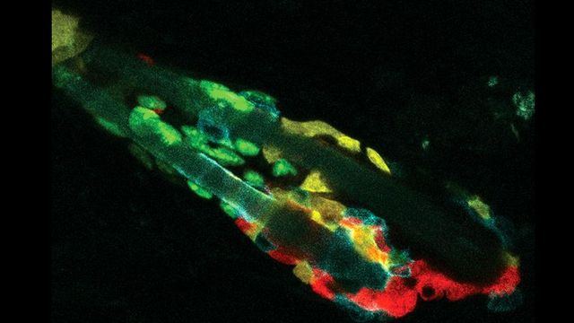 Mechanism Behind the Removal of Dead Hair Follicle Cells Discovered ...