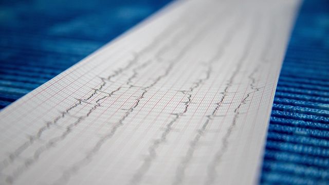 Wearable Heart Monitors Detect More Atrial Fibrillation but Don’t Lower ...