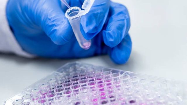 How To Transition From Liquid to Lyophilized PCR Assays | Technology ...