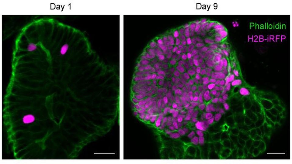 Organoid Study Reveals How Tuft Cells Act as Reverse Stem Cells After ... Organoid Study Reveals How Tuft Cells Act as Reverse Stem Cells After ...