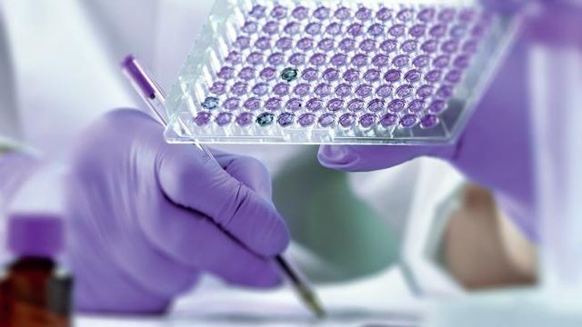 Maximize Your Microplate Assay Results | Technology Networks