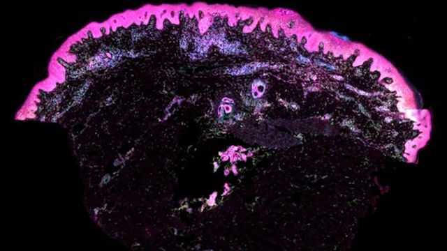 Prenatal Skin Atlas Reveals Secrets of Skin Development | Technology ...