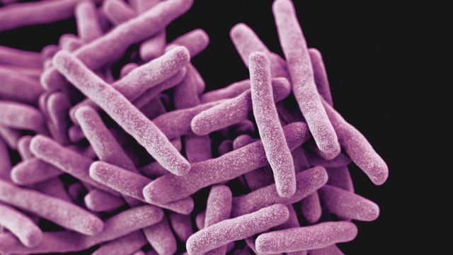 Experimental Cancer Drug Shows Promise Against Tuberculosis