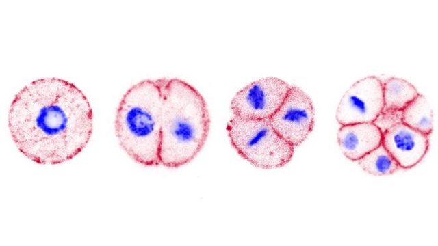 Ancient Unicellular Organism Says Eggs Came Before Chickens ...