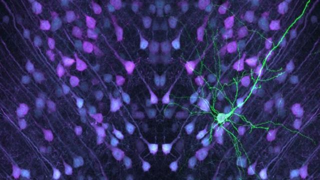 Neurons in Autism and Schizophrenia: New Proteomics Insights ...