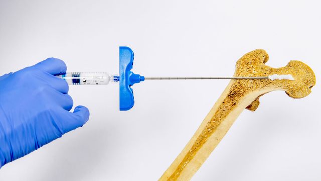 Novel Injectable Hydrogel for Local Bone Densification | Technology ...