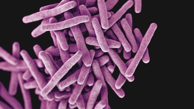 Engineered Mycobacteria Boost TB Vaccine Safety | Technology Networks