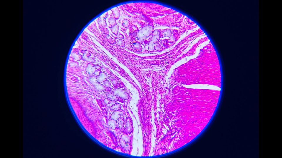 Mapping Genetic Activity to Distinct Tissue Regions | Technology Networks