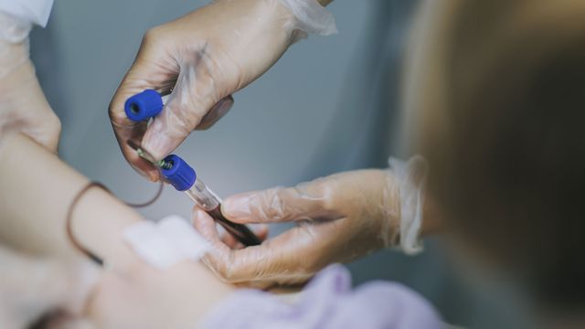 Benchtop NMR: A Diagnostic Tool for Cardiovascular Risk | Technology ...
