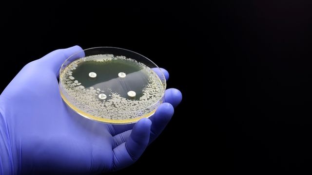 Bacterial Transformation and Transformation Protocol | Technology Networks