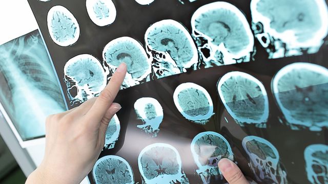Non-Invasive Method Boosts Brain Waste Drainage | Technology Networks Non-Invasive Method Boosts Brain Waste Drainage | Technology Networks