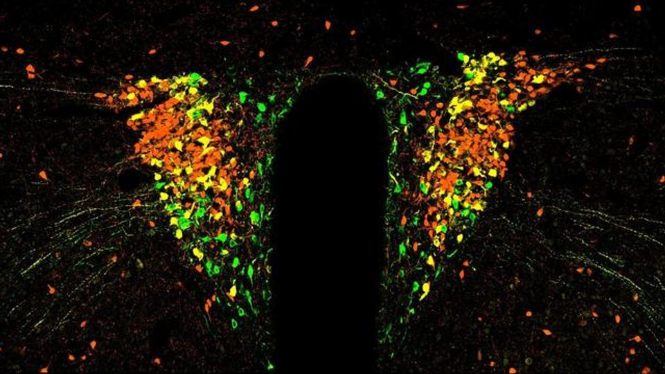 Stress Brain Cells Fire Every Hour, Even Without Stress | Technology ...