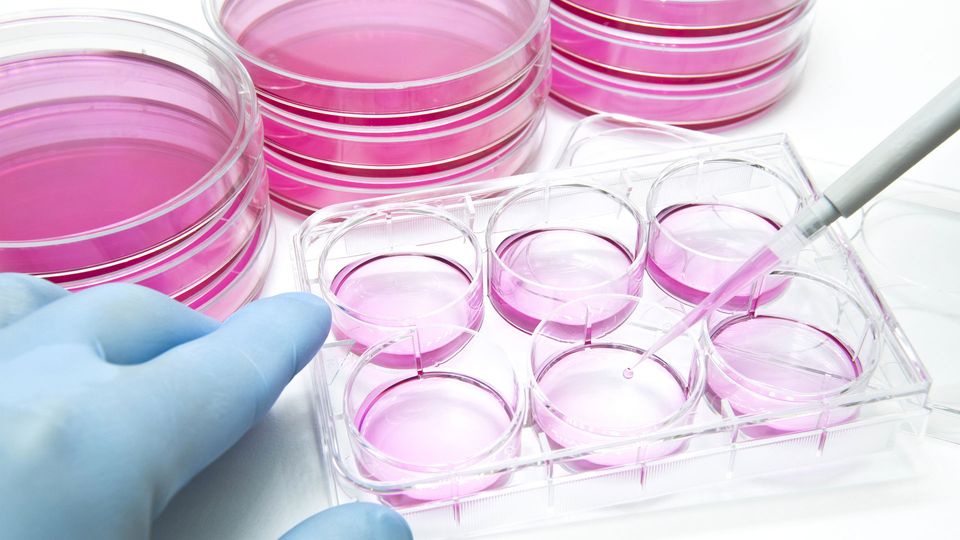 Organoid Development Predicted by Machine Learning | Technology Networks