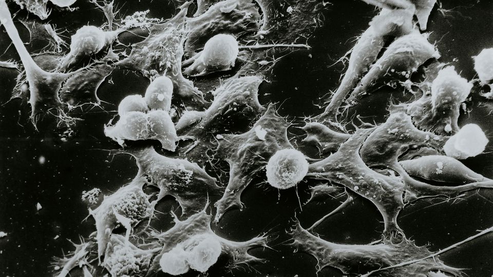 Dormant Tumor Cells Linked to MYCN Location | Technology Networks
