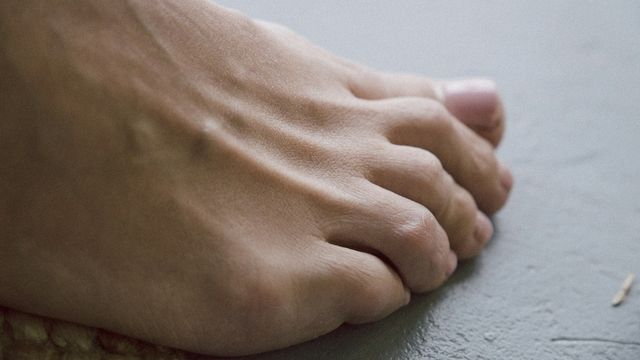 CRISPR Reactivates Ancient Gene To Treat Gout | Technology Networks