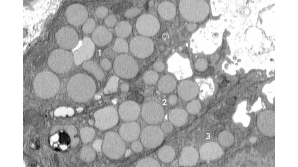 Cathartocytosis: Newly Discovered Cell Cleansing Process | Technology ...