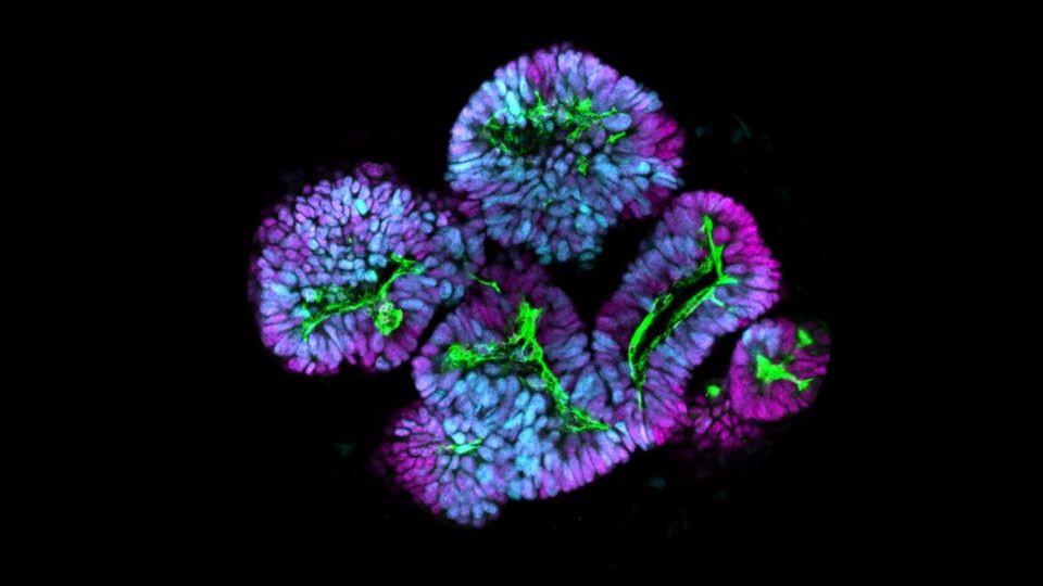 Blueprint Revealed for Producing Human Kidney Cell Types | Technology ...