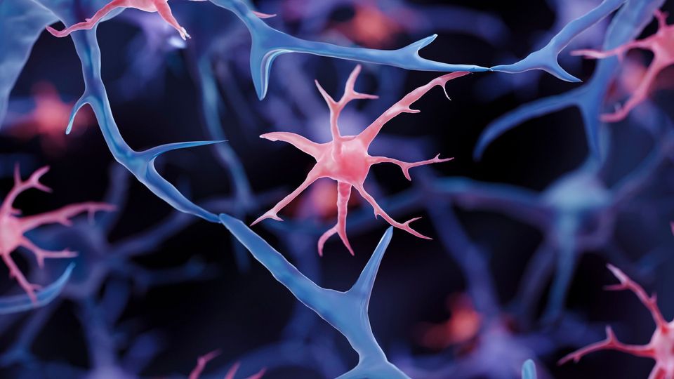 Defective Exosome Production Linked to Alzheimer’s | Technology Networks
