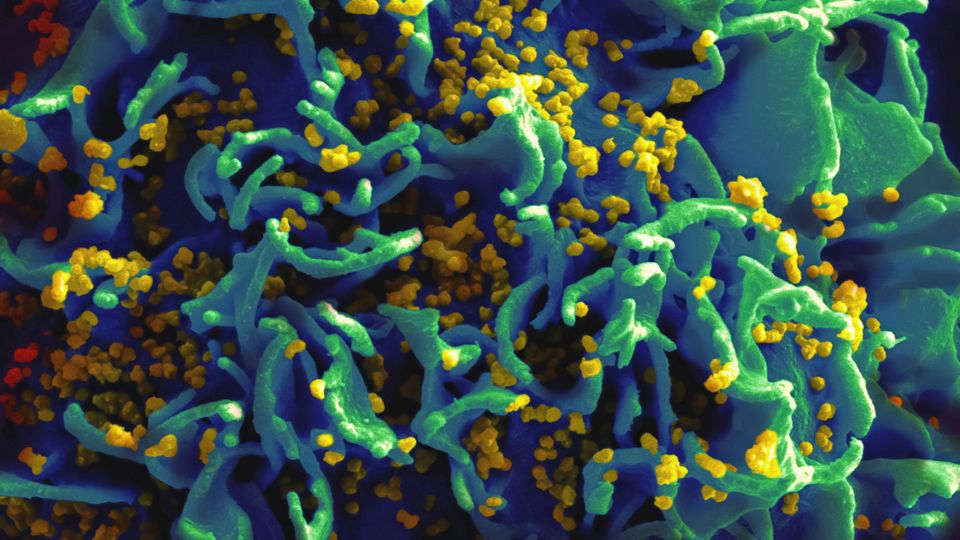 HIV-1 Targets R-Loops To Enter Genome | Technology Networks