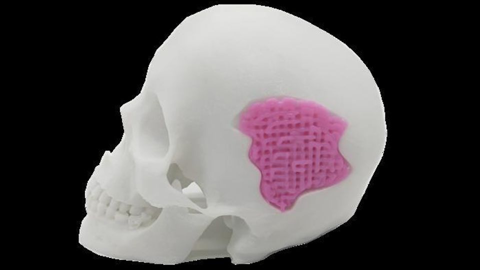 3D-Printed Glass: A New Bone Substitute? | Technology Networks