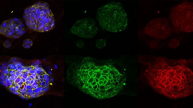 AI Reprograms Cancer Cells to Self-Destruct | Technology Networks