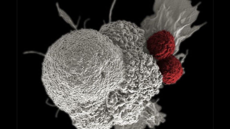 Gamma-Delta Cells Target Therapy-Resistant Bowel Cancer | Technology ...