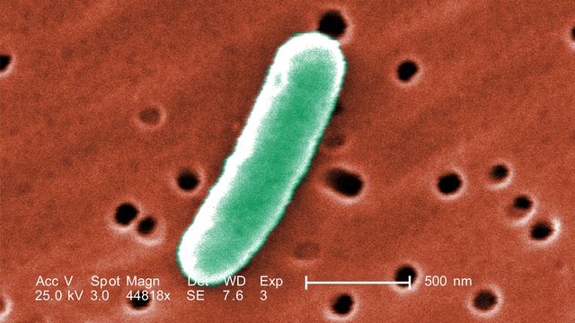 E. coli Uses Protein to Stop Gut Cell Protection | Technology Networks