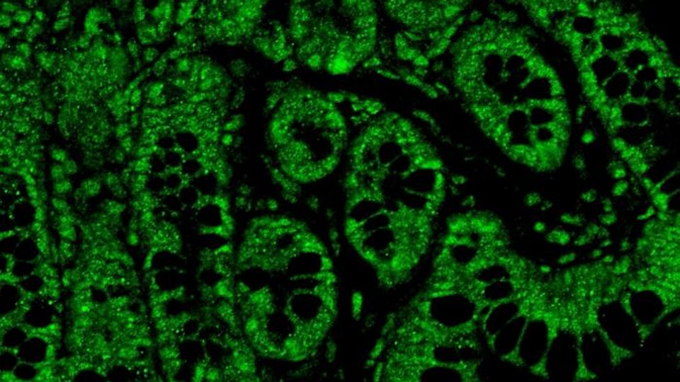 Low-Dose THC Reduces HIV Drug Side Effects | Technology Networks