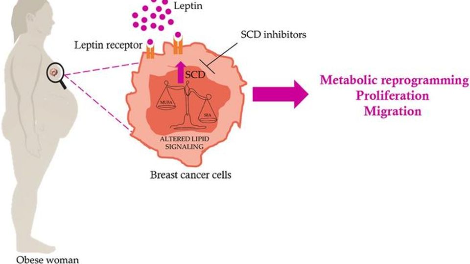 Leptin–SCD Pathway Fuels Breast Cancer Growth | Technology Networks