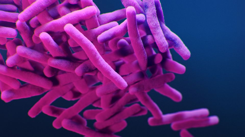 Tuberculosis Study Identifies Immune Signatures | Technology Networks