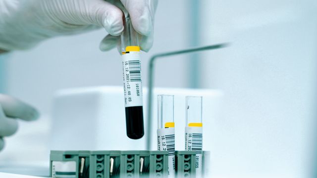 Midlife Blood Test May Predict Alzheimer’s Disease Risk | Technology ...