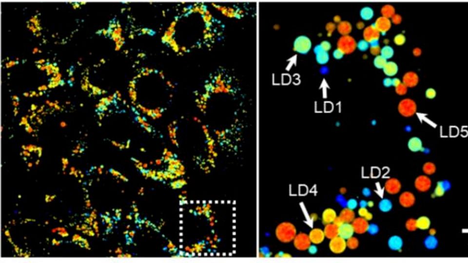 Fluorescent Probe Tracks Lipid Breakdown in Live Cells | Technology ...