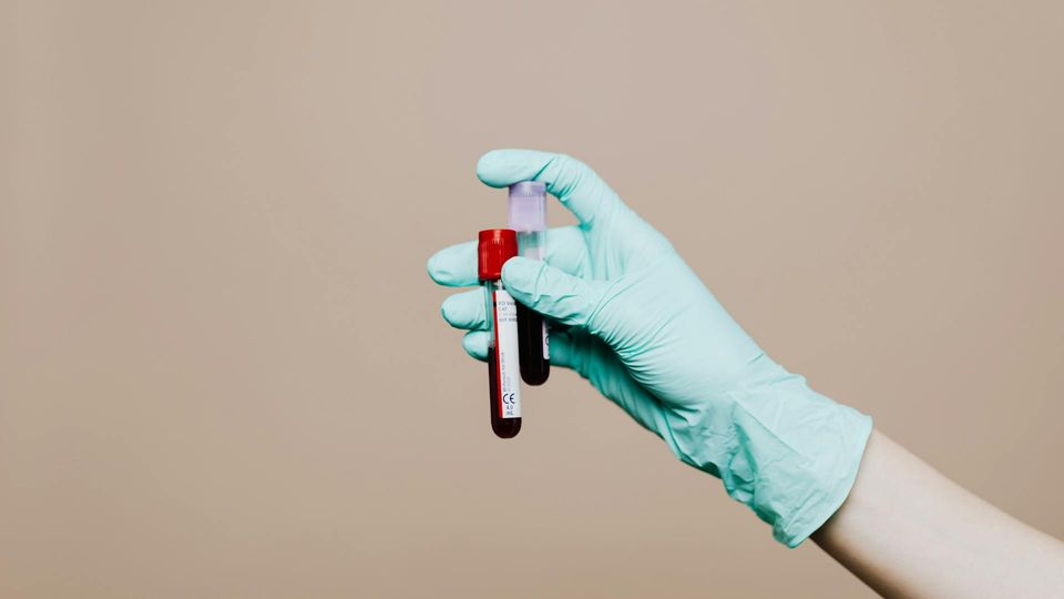Inflammation Drives Early Bone Marrow Disorders | Technology Networks