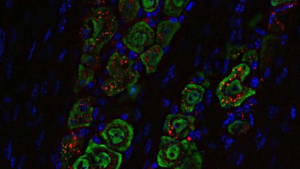 Nasal Nano-Medicine for Brain Cancer | Technology Networks