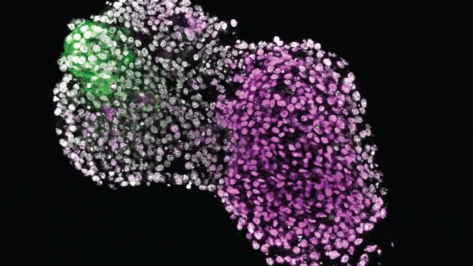 Organoids Model Limb Development and Cartilage Growth | Technology Networks