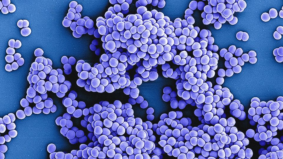 Staphylococcus aureus: Insights From 1,000 Noses | Technology Networks