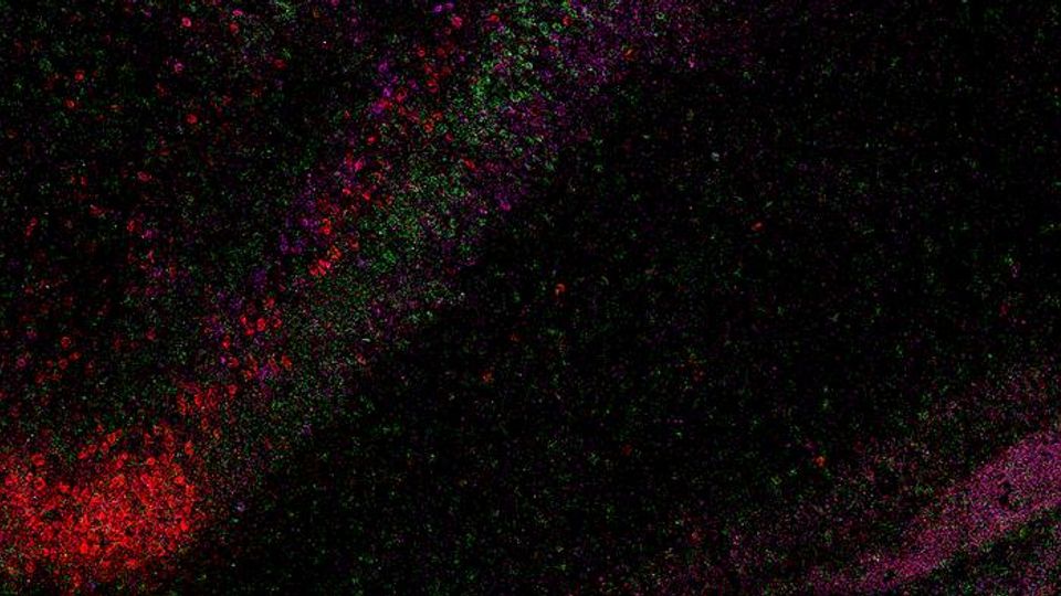 Hidden Layers Found in the Brain’s Memory Center | Technology Networks