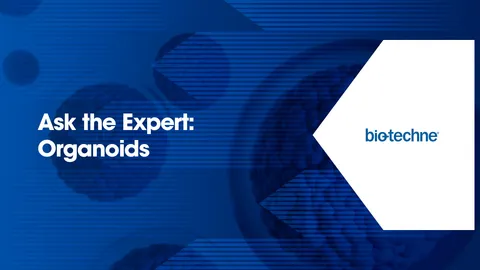 KRAS G12R Mutation Linked to Less Aggressive Pancreatic Cancer ...