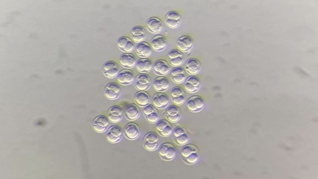 Early Development Genes May Help Treat Muscle Disease | Technology Networks